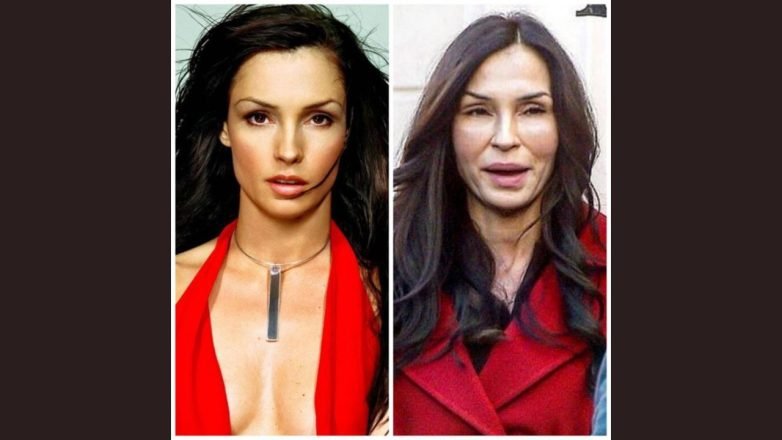 Famke Janssen Plastic Surgery After And Before Transformation